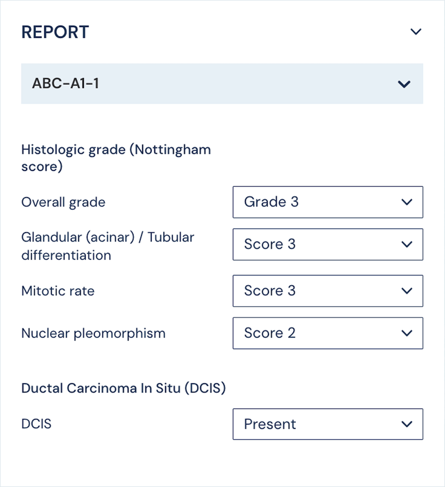 Harmony on the horizon – could AI standardize breast cancer grading?