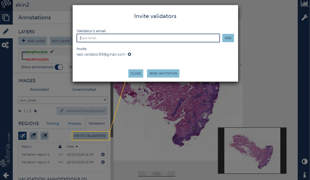 Aiforia® Create feature: validation