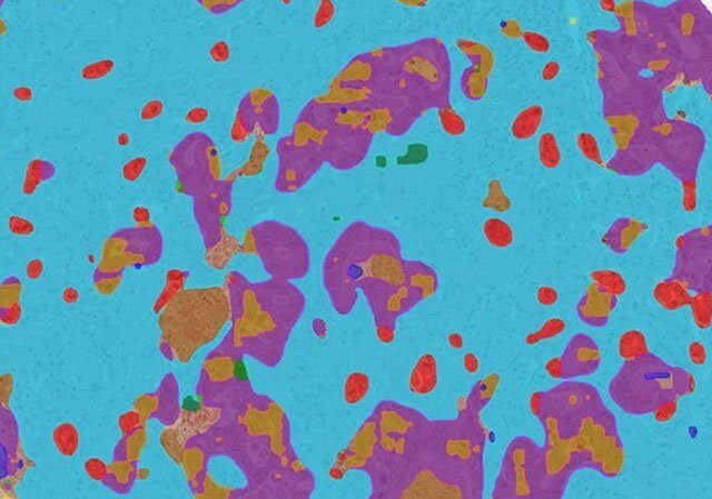 Aiforia | Our Products | Aiforia Create