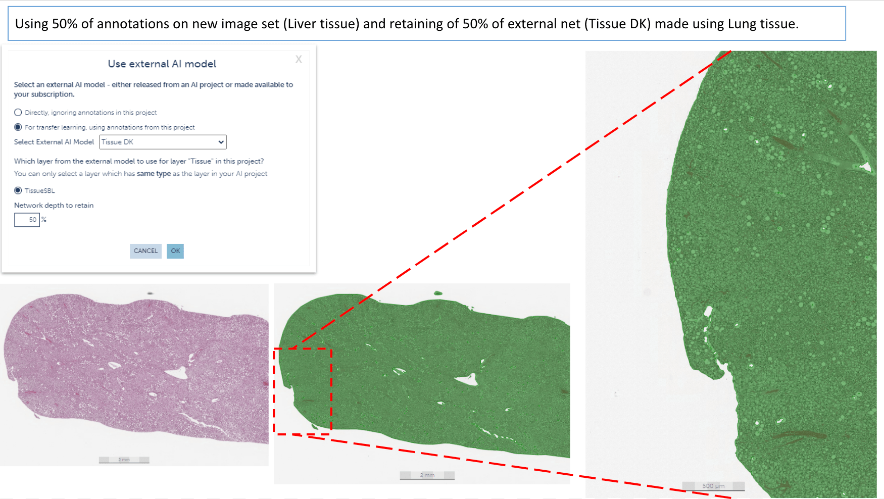 Aiforia® Create feature: transfer learning