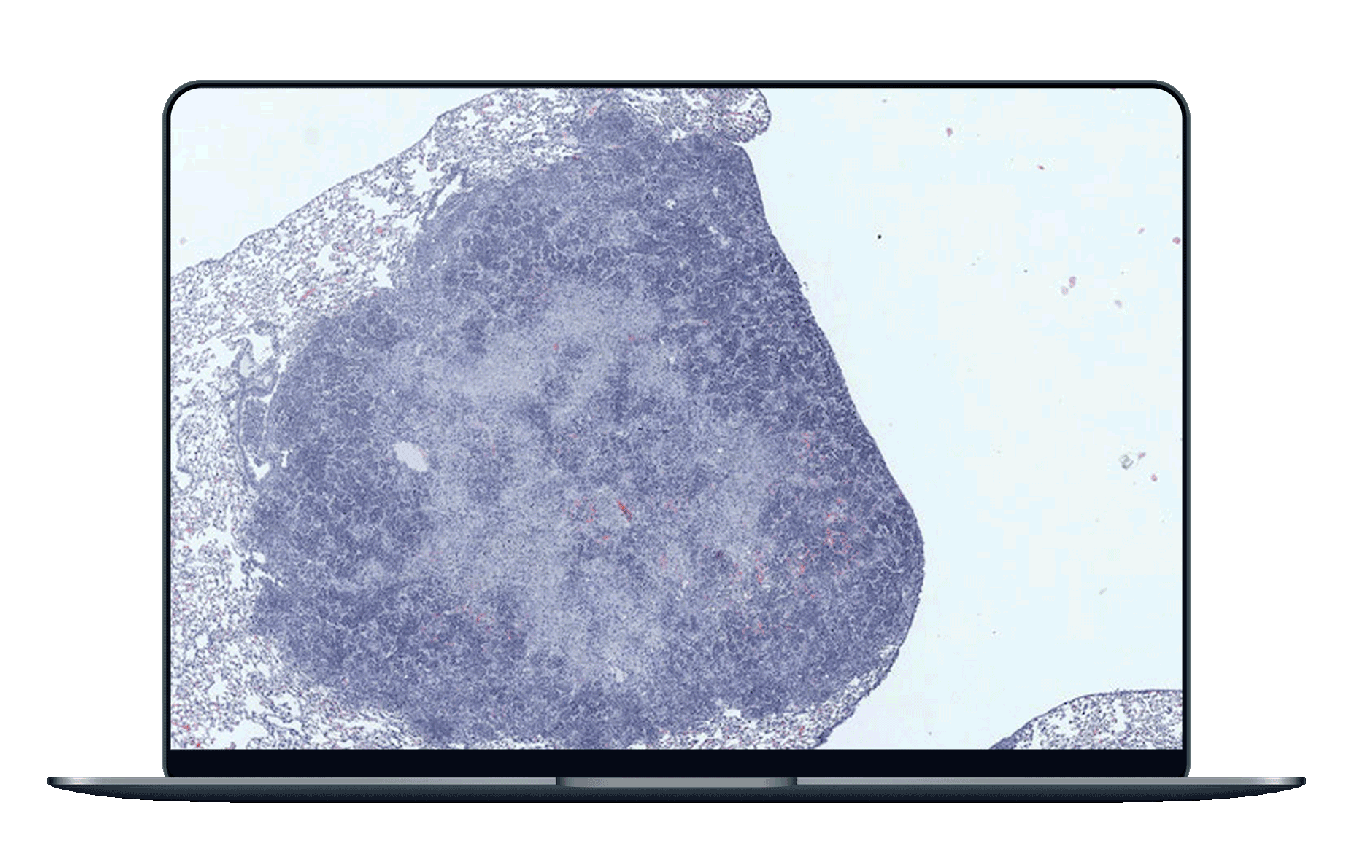 Case study: infectious diseases and AI