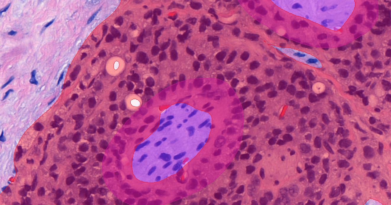 Prostate Cancer Suite