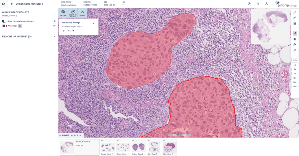 Industry-academia collaboration led to a CE-IVD marked AI solution