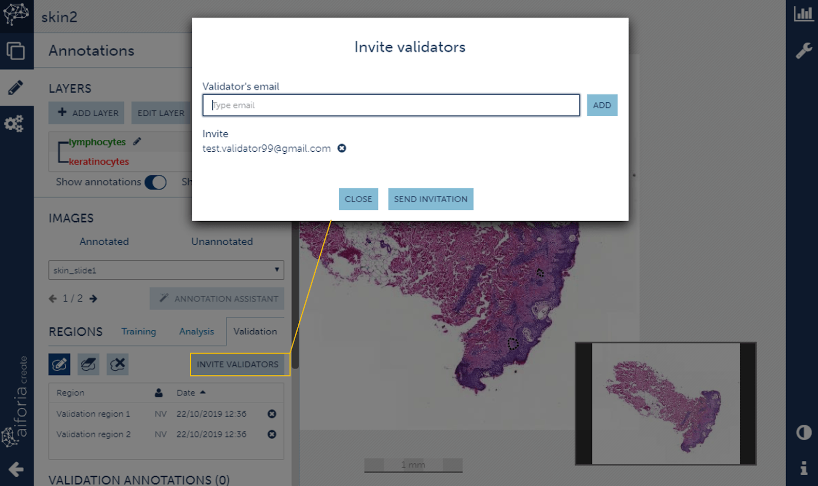 Aiforia | Our Products | Aiforia Create