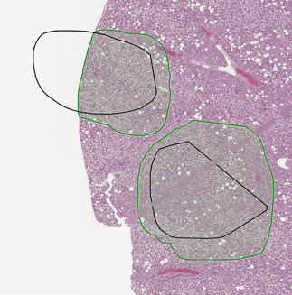 Aiforia | Our Products | Aiforia Create