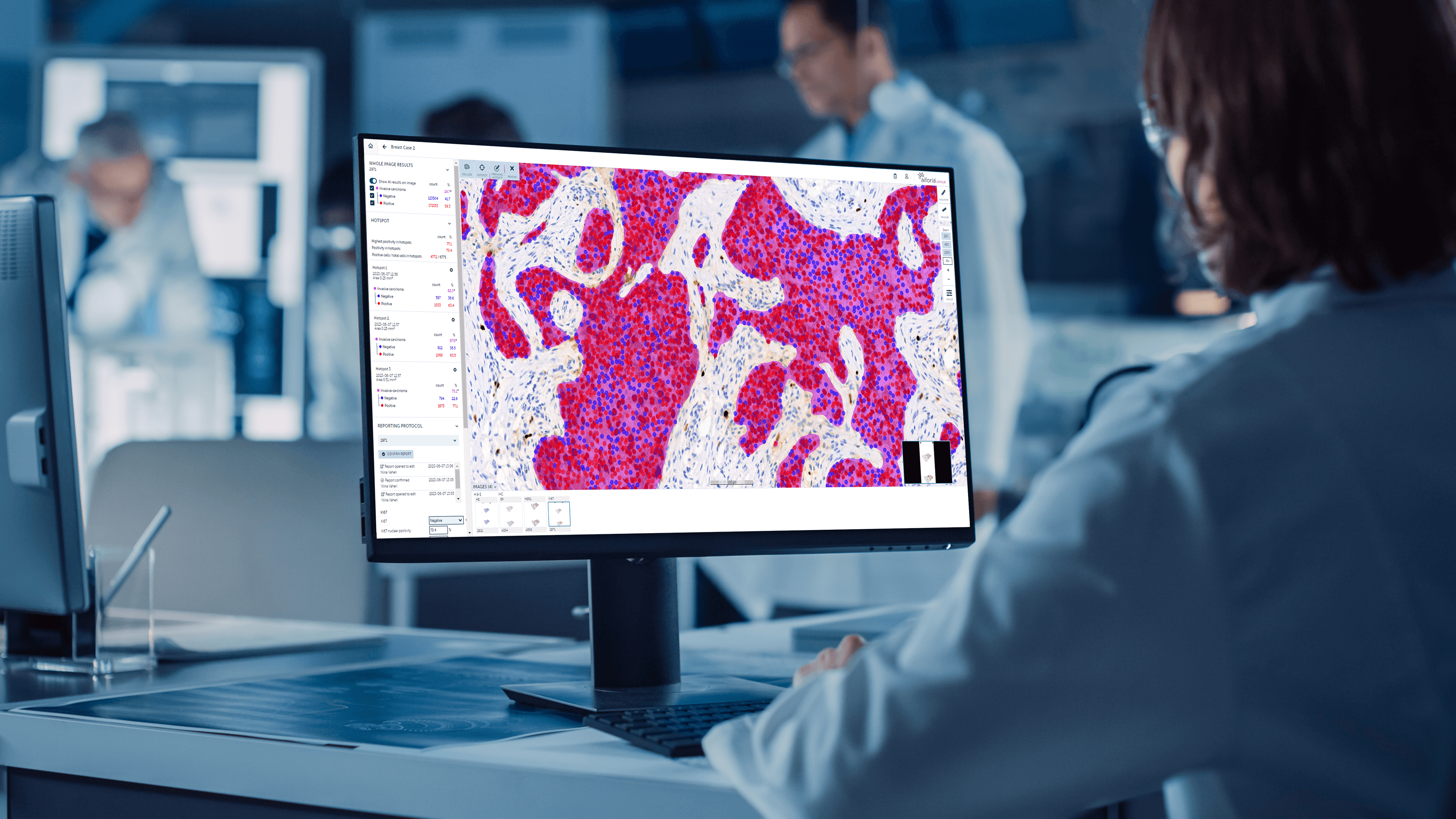 Aiforia's clinical solutions