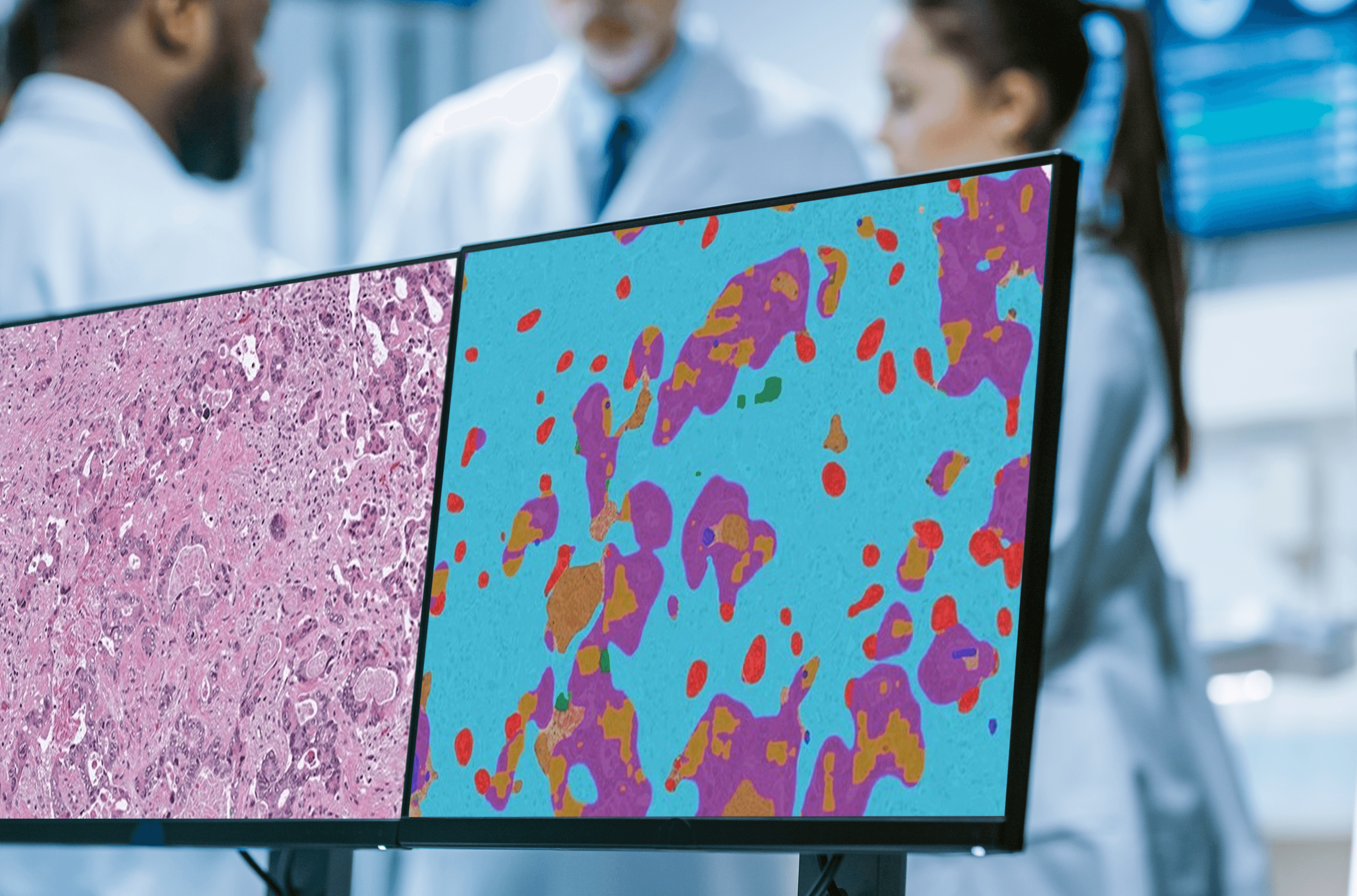 Case study: creating a prognostic AI model for colorectal cancer