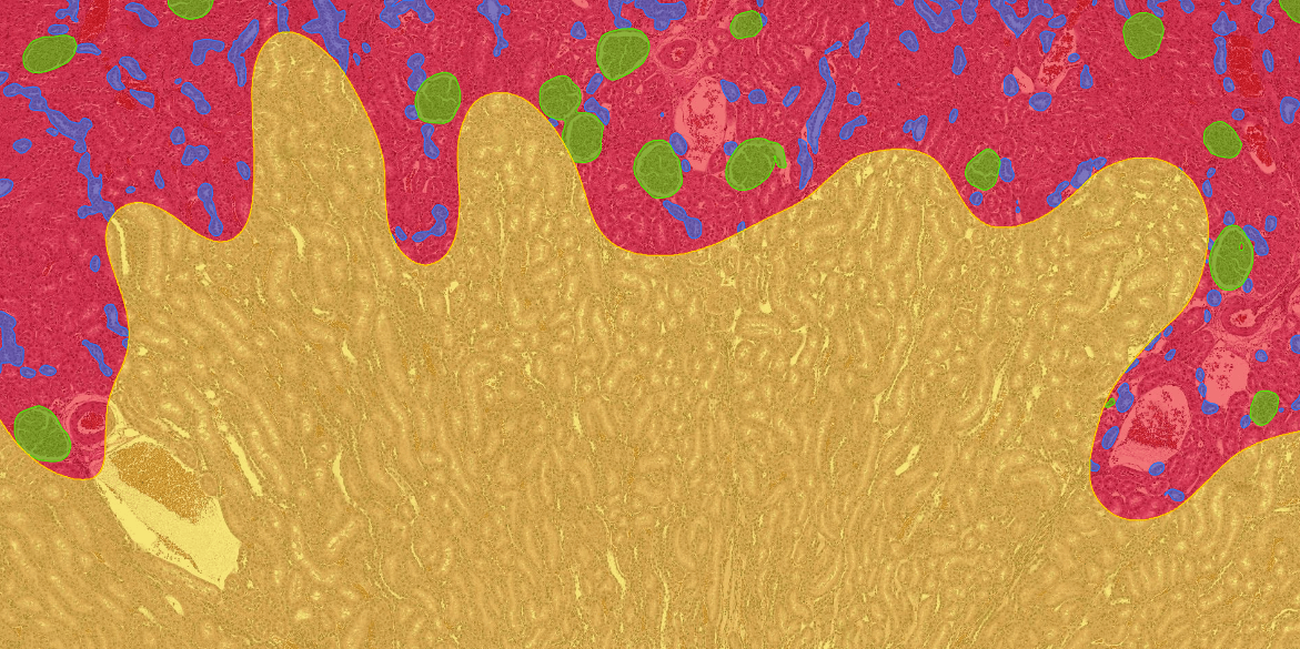 Aiforia® Create features: object detection, semantic and instance ...