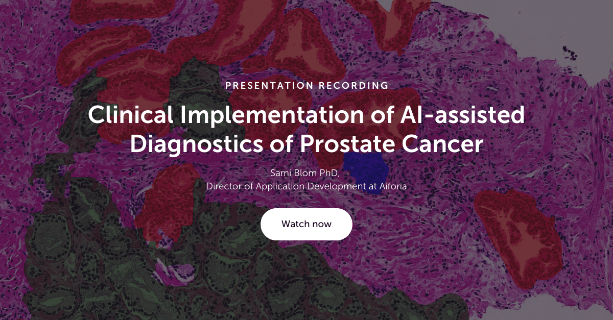 Clinical Implementation of AI-assisted Diagnostics of Prostate Cancer Clinical Implementation of AI-assisted Diagnostics of Prostate Cancer