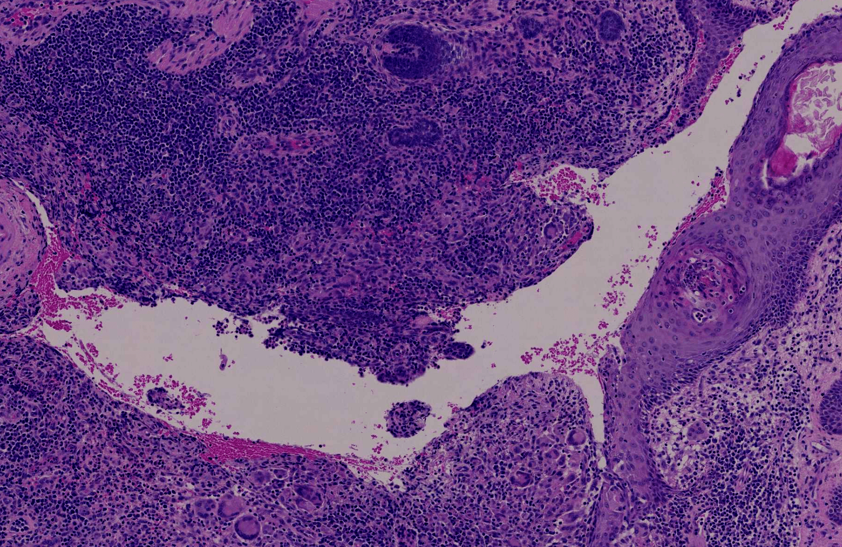 Aiforia secures U.S. patent for high-speed AI training tool in medical ...