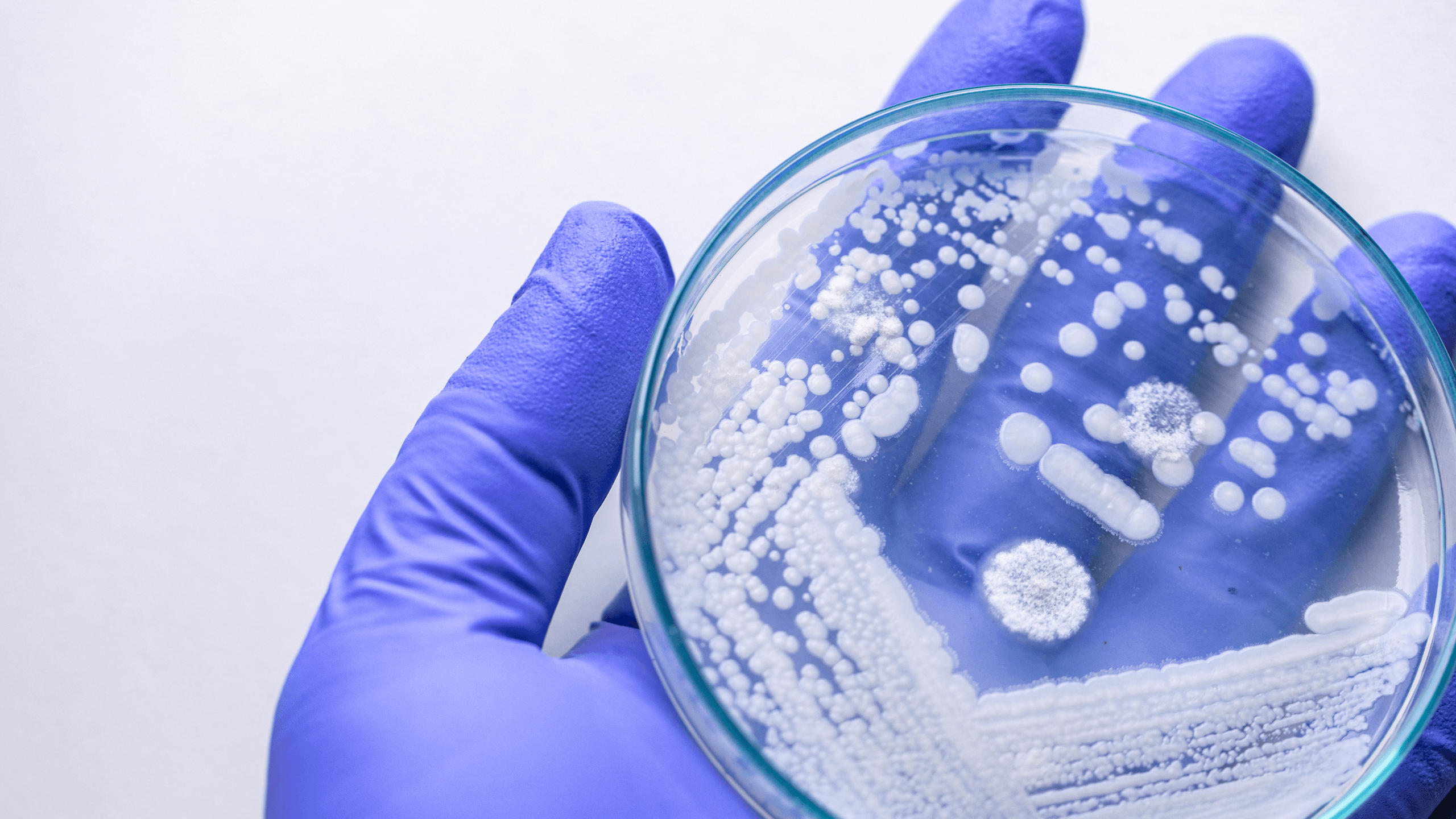 Case study: AI-aided identification of yeast contamination