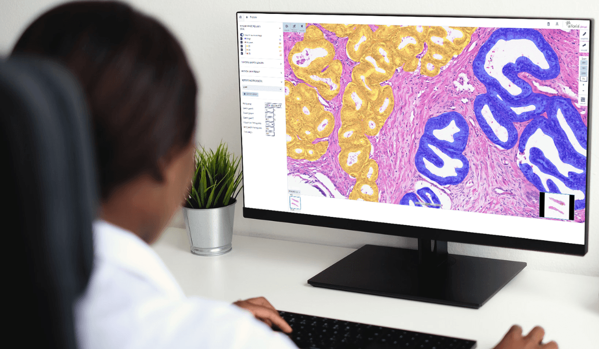 Guest blog: evolution of artificial intelligence in diagnostic pathology