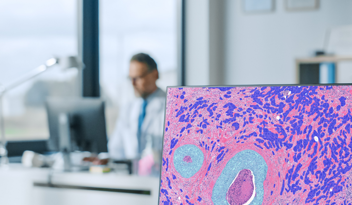 Aiforia releases a new CE-IVD-marked clinical AI solution for breast ...