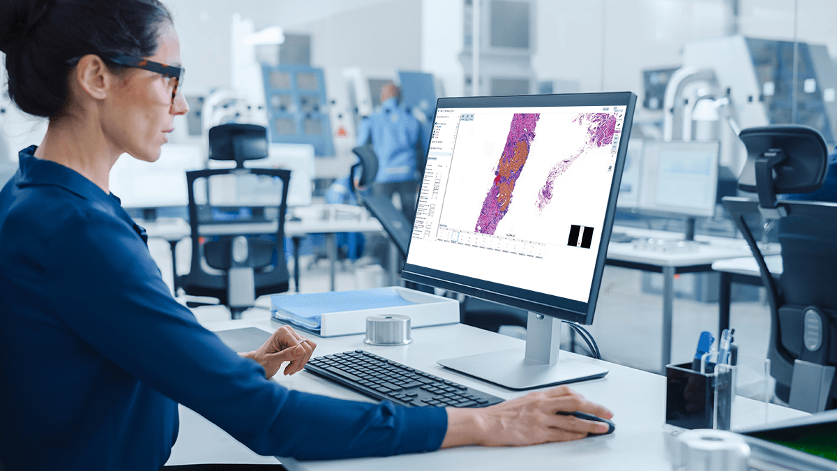 Aiforia releases another CE-IVD marked clinical AI Model — expanding ...