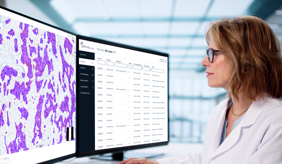 Aiforia’s AI solutions for breast cancer diagnostics implemented at ...