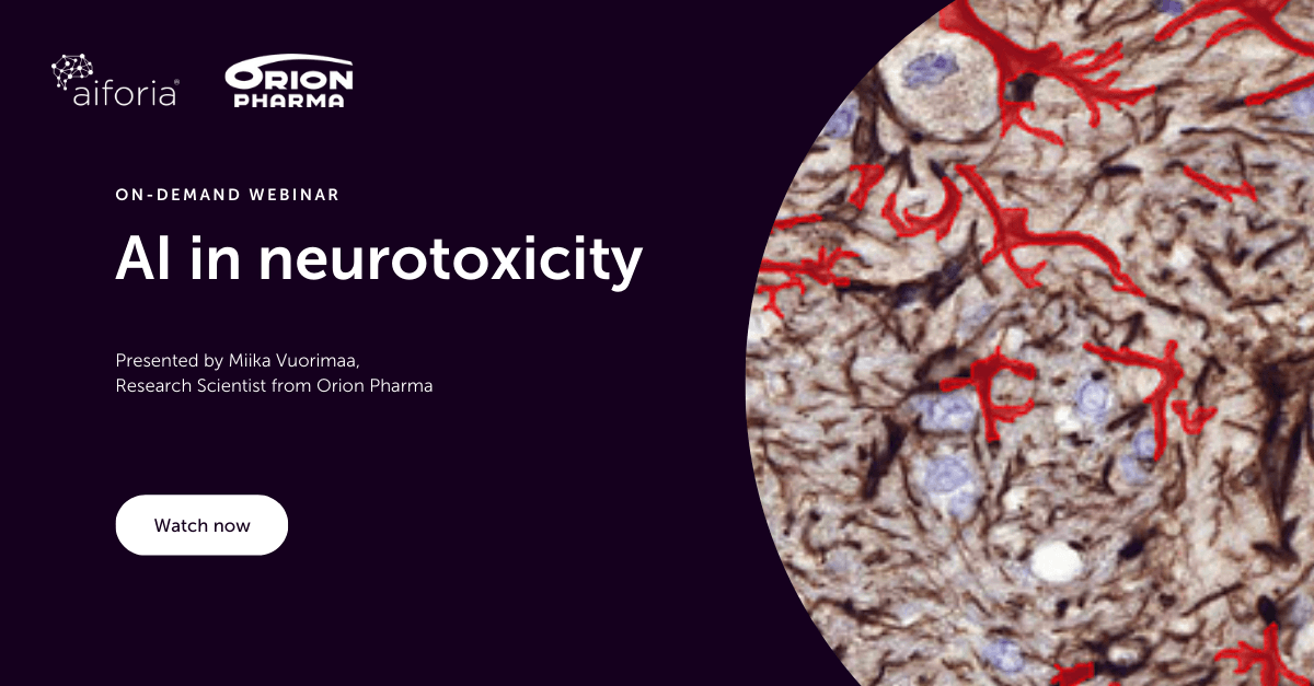 AI in Neurotoxicity